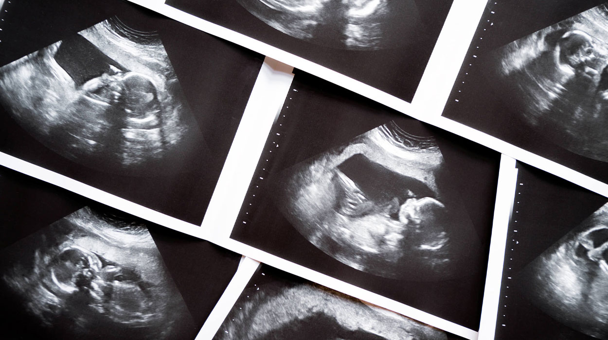 Advanced Ultrasound - Mama's Miracle Consultancy